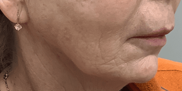 Gallery - Dr Heather Iverson